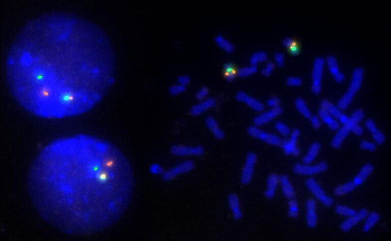 Integrated solution for tissue-based FISH - Excilone