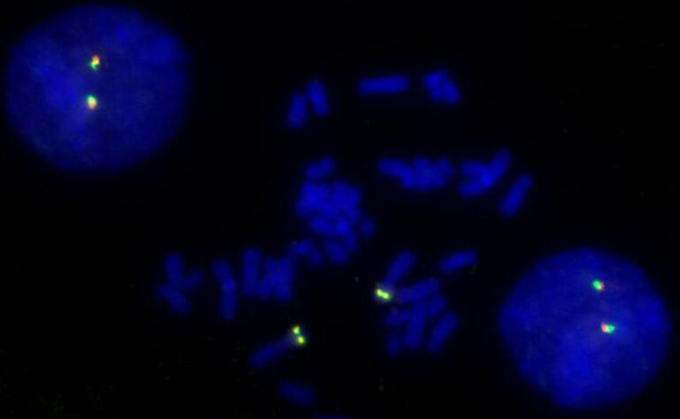 Solution intégrée pour la FISH sur tissus - Excilone Systemes
