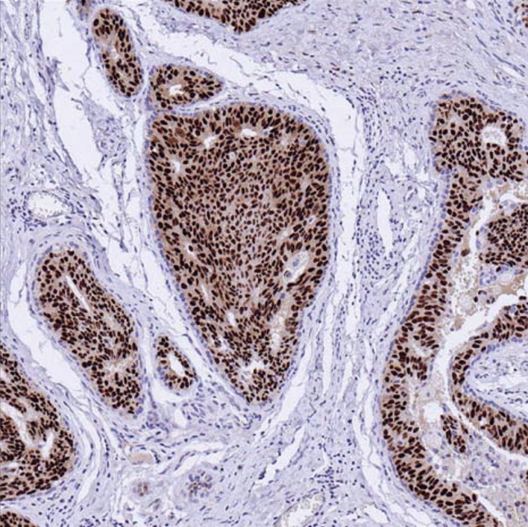 Solutions pour la pathologie - Excilone Systemes