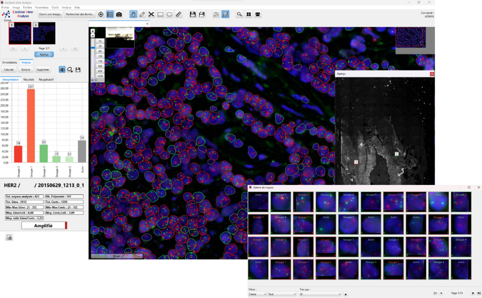 Solution intégrée pour la FISH sur tissus - Excilone